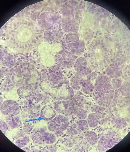 Gi Lab 6 Accessory Organ Histology Flashcards Quizlet