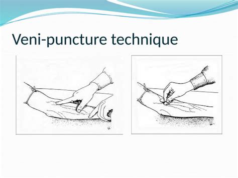 Blood Collection Via Different Techniques PPTX