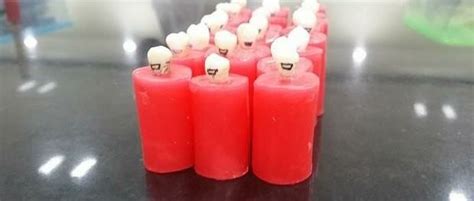 Teeth Mounted On A Custom Made Wax Block Standardised Class V Cavities Download Scientific