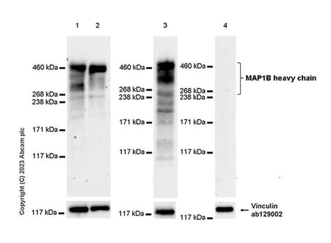 Anti Map1b Antibody Epr27224 93 Bsa And Azide Free Ab315227 Abcam