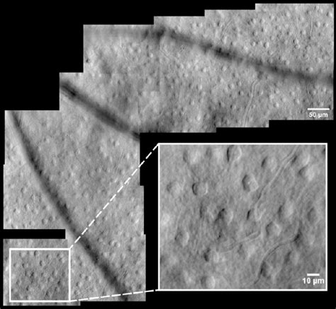 Sparse Cellular Mosaic Captured In The Outer Plexiform Layer The Download Scientific Diagram