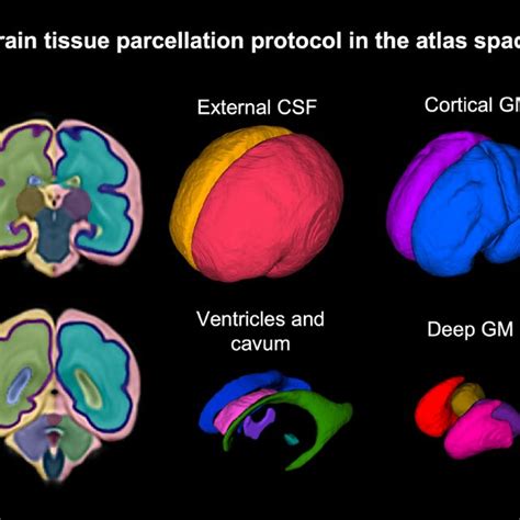 Proposed Tissue Parcellation Protocol Defined In The Dhcp Fetal Brain