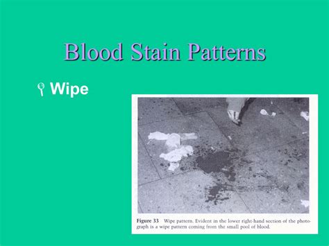 Lecture Forensic Serology Ppt Download
