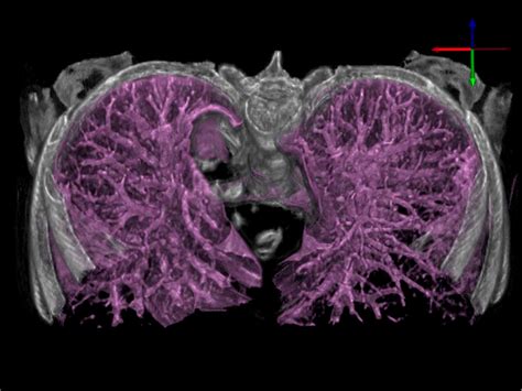 Visualization Of 4d Ct Scan Datasets ← Nicolas J Dedual Etc