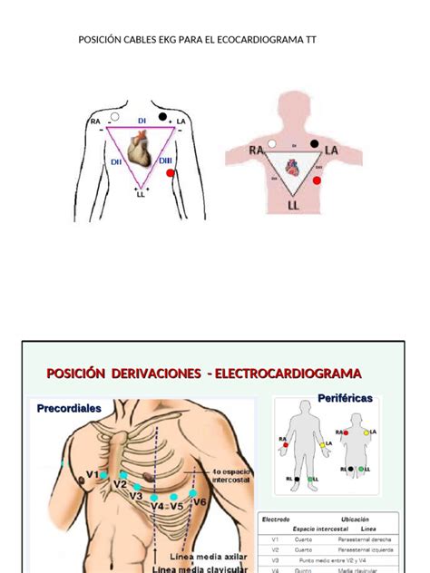 Colocación De Electrodos Ekg Y Holter Pdf Arco Iris Sistema
