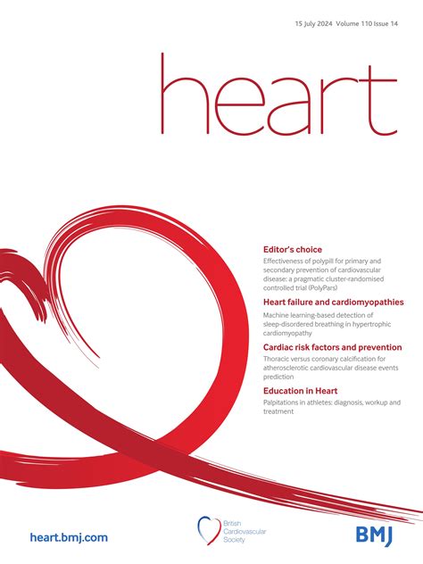 Palpitations In Athletes Diagnosis Workup And Treatment Heart