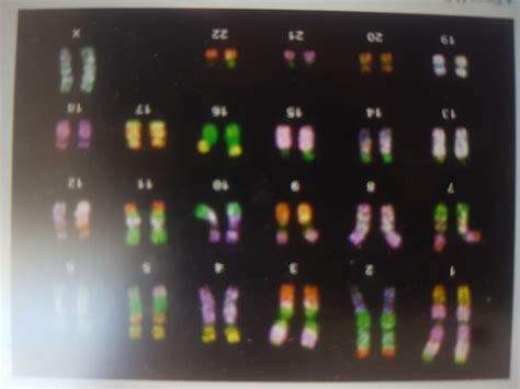 Chromosomes Flashcards Quizlet