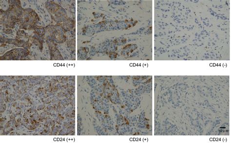 Immunohistochemical Staining Patterns With Cd44 And Cd24 On Download Scientific Diagram