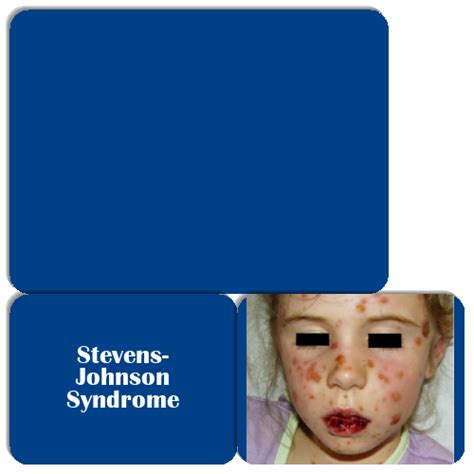 Emergency Dermatology Match The Memory