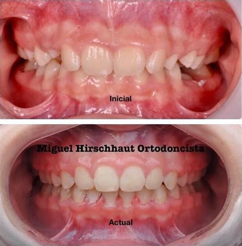 Dr Miguel Hirschhaut Ortodoncista Phd Doctor En Odontología La