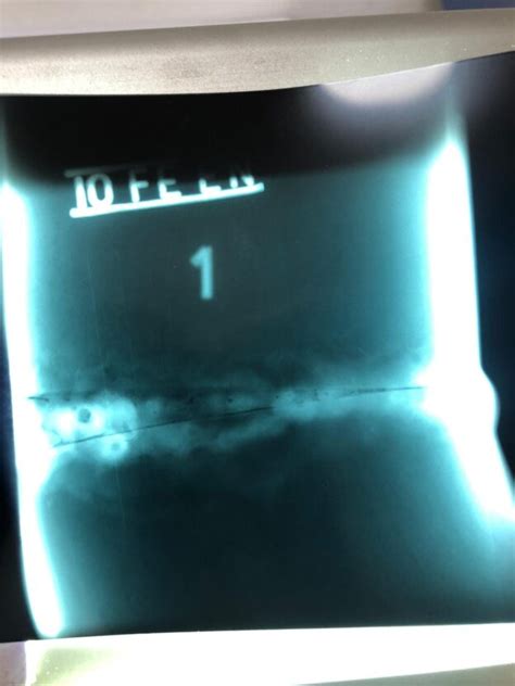 What Is Ndt Non Destructive Testing And Inspection Methods Ndt Inspect Ndt Career And