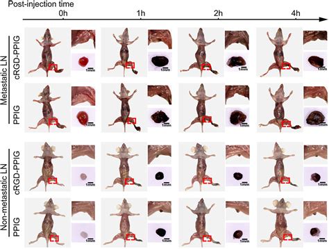 Tumor Targeted Polydopamine Based Nps For Multimodal Mapping Ijn