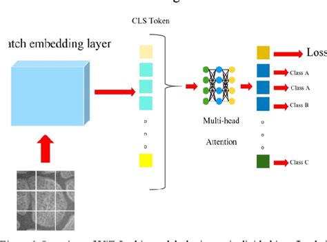 Figure 1 From A Method For Predicting Bone Age Using Vision Transformer Semantic Scholar