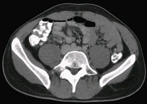 Dr Medhat Ashour On Linkedin Rology Teleradiology Radiology