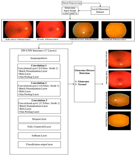 An Adoptive Threshold Based Multi Level Deep Convolutional Neural