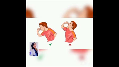 How We Will Stop The Epistaxis Youtube