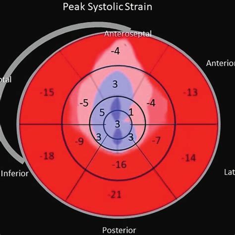 Global Longitudinal Strain Plot On Transthoracic Echocardiography With