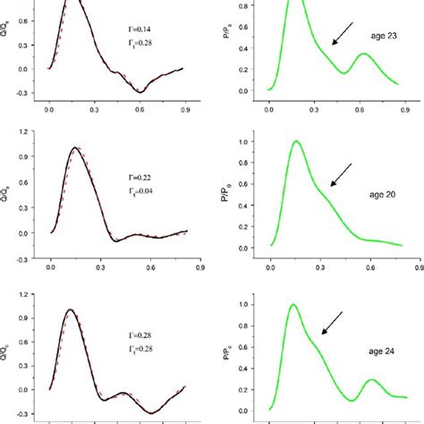 Examples Of Recorded Radial Artery Pressure Waveforms Left Young