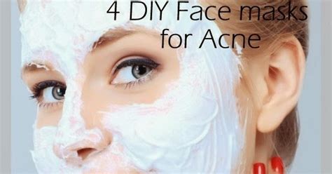 Diy Homemade Mask For Acne Vulgaris Home Remedies For Acne How To Get