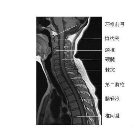 面状图 枝状图 线状图 大山谷图库