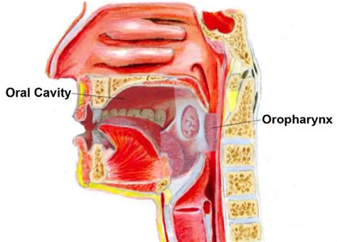 Oral Cavity Staging A Red Flag A Case Of Oropharyngeal Cancer