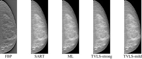 The Images Are Reconstructed Slices Using The Five Reconstruction Download Scientific Diagram
