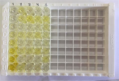 Human P Selectincd62p Elisa Quantikine Dpse00 Randd Systems