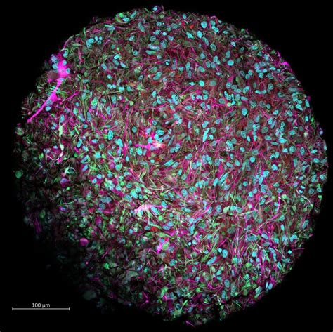 A New Field Of Computing Powered By Human Brain Cells “organoid Intelligence”