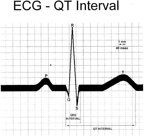 Qt Prolongation Of The Heart