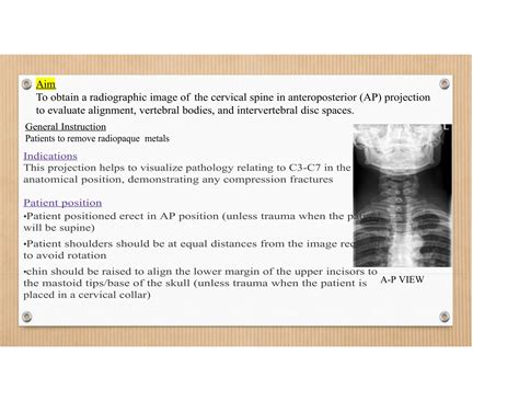 Cervical Spine Docx Cervical Spine Imaging Techniques Docx