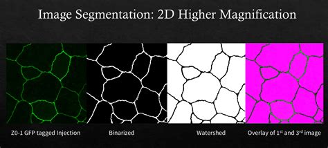 Image Segmentation Using Matlab Vignesh Aravind Project Page
