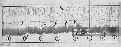 Polygraph Chart