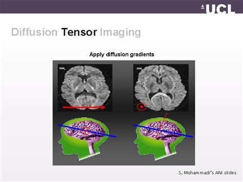 Diffusion Tensor Imaging Overview Theory Basic Physics Tensor