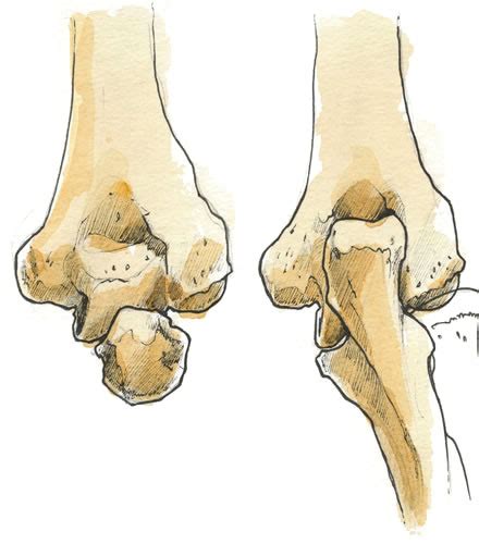 Elbow Joint Extensor Aspectx500h Mr Donald Sammut Frcs Frcs Plast