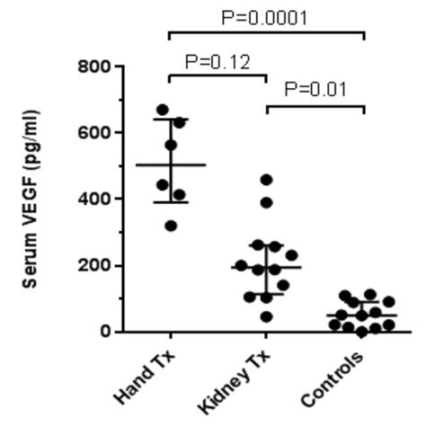 Correlation Between Serum Vegf Levels And Average Capillary Diameter Download Scientific Diagram