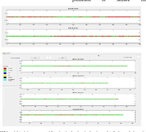 Figure 1 From Use Of Electrographic Seizures And Interictal Epileptiform Discharges For
