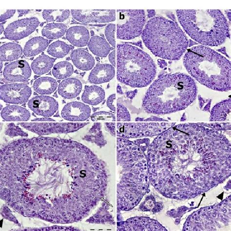 Electron Micrographs Of A Mouse Testis Of The Control Groups Download Scientific Diagram