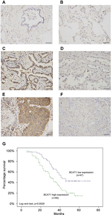bcat1 expression is increased in lung cancer tissues a negative weak