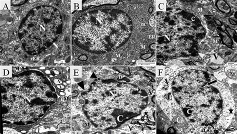 Electron Micrographs Of Ultrathin Sections Of Superficial Region Of
