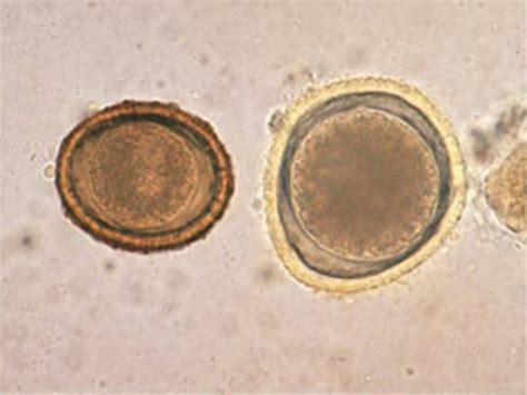 Toxocara Canis Egg Morphological Observations Of Toxocara Canis
