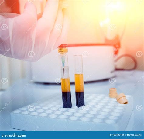 Platelet Rich Plasma Injection Procedure Hair Growth Stimulation Prp