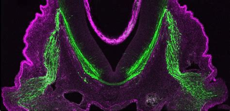 Discerning The Different Types Of Microscopy In Biomedical Research