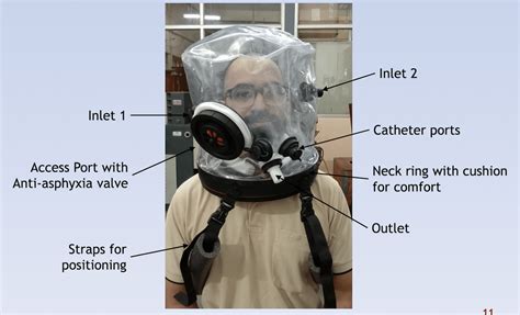 Helmet Interface Non Invasive Ventilation At Phillip Danforth Blog
