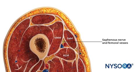 Anatomy Of The Adductor Canal Sartorius Muscle Sam Vastus Medialis