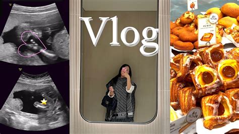 Vlog 16주 임산부 일상 성별확인👼🏻 2차기형아검사 초음파확인 골프연습하고 빵사먹는 임산부 일상 🤰🏻 Youtube