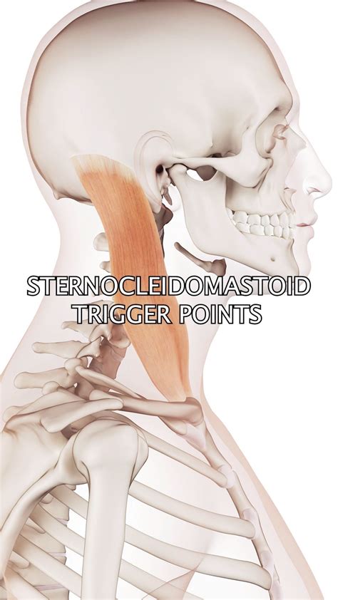 How To Treat A Trigger Point Subscapularis Artofit