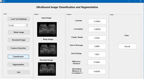 Gui Representation Of Classification For Normal Image See Online Download Scientific Diagram