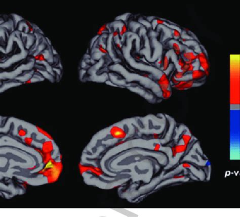 A B Part A Depicts Cortical Parcellation Depicting Regions Of Interest Download Scientific