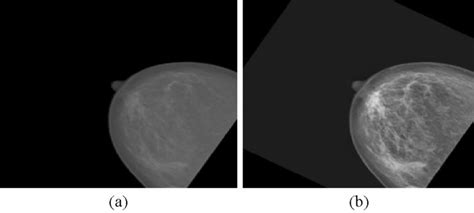 Sample Image Of Inbreast Dataset A Input Mammogram Image B Input