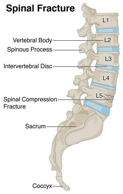 Spinal Fractures Norelle Health